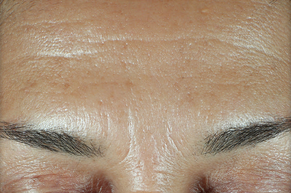 RETINOL CORREXION® Deep Wrinkle Filler Serum - RoC® Skincare