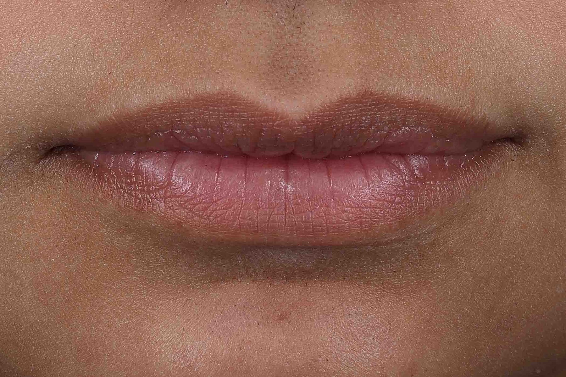 DERM CORREXION® Lip Volumizer - RoC®️ Skincare – RoC® Skincare