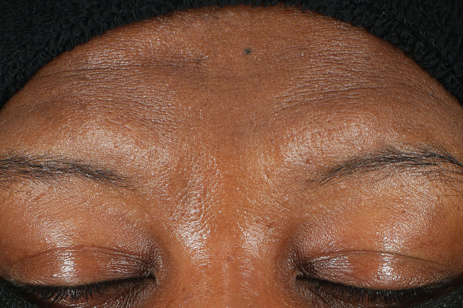 Deep Wrinkle Daily Routine Skincare Set - RoC® Skincare