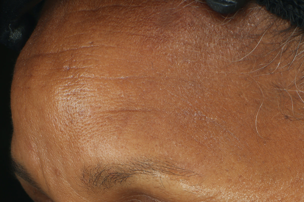 Deep Wrinkle Daily Routine Skincare Set - RoC® Skincare