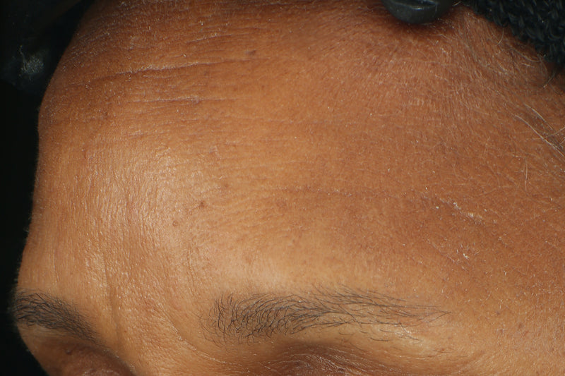 Deep Wrinkle Daily Routine Skincare Set - RoC® Skincare