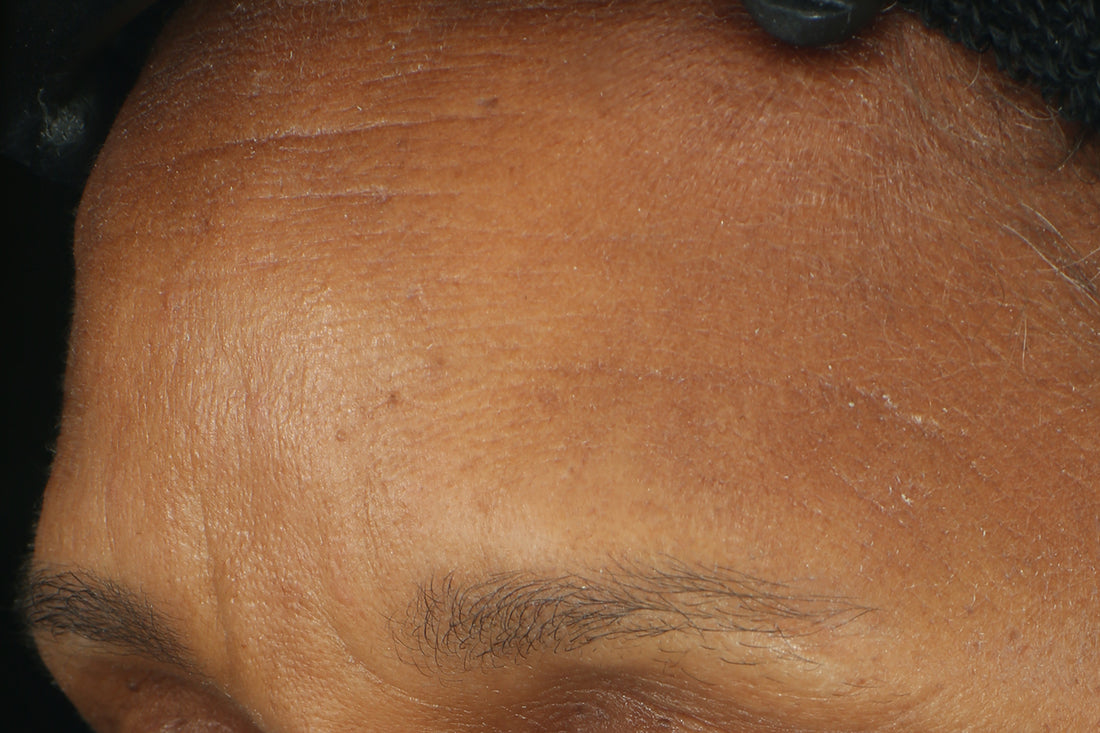 Deep Wrinkle Daily Routine Skincare Set - RoC® Skincare