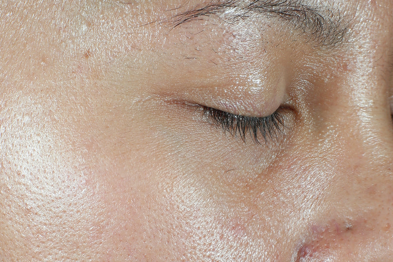 MULTI CORREXION® Revive + Glow Eye Balm - RoC® Skincare