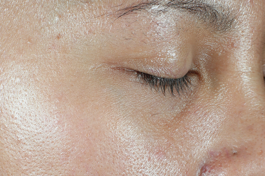 MULTI CORREXION® Revive + Glow Eye Balm - RoC® Skincare