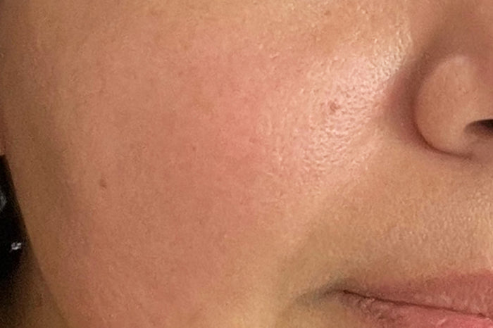 Barrier Renew® PM Moisturizer - RoC® Skincare