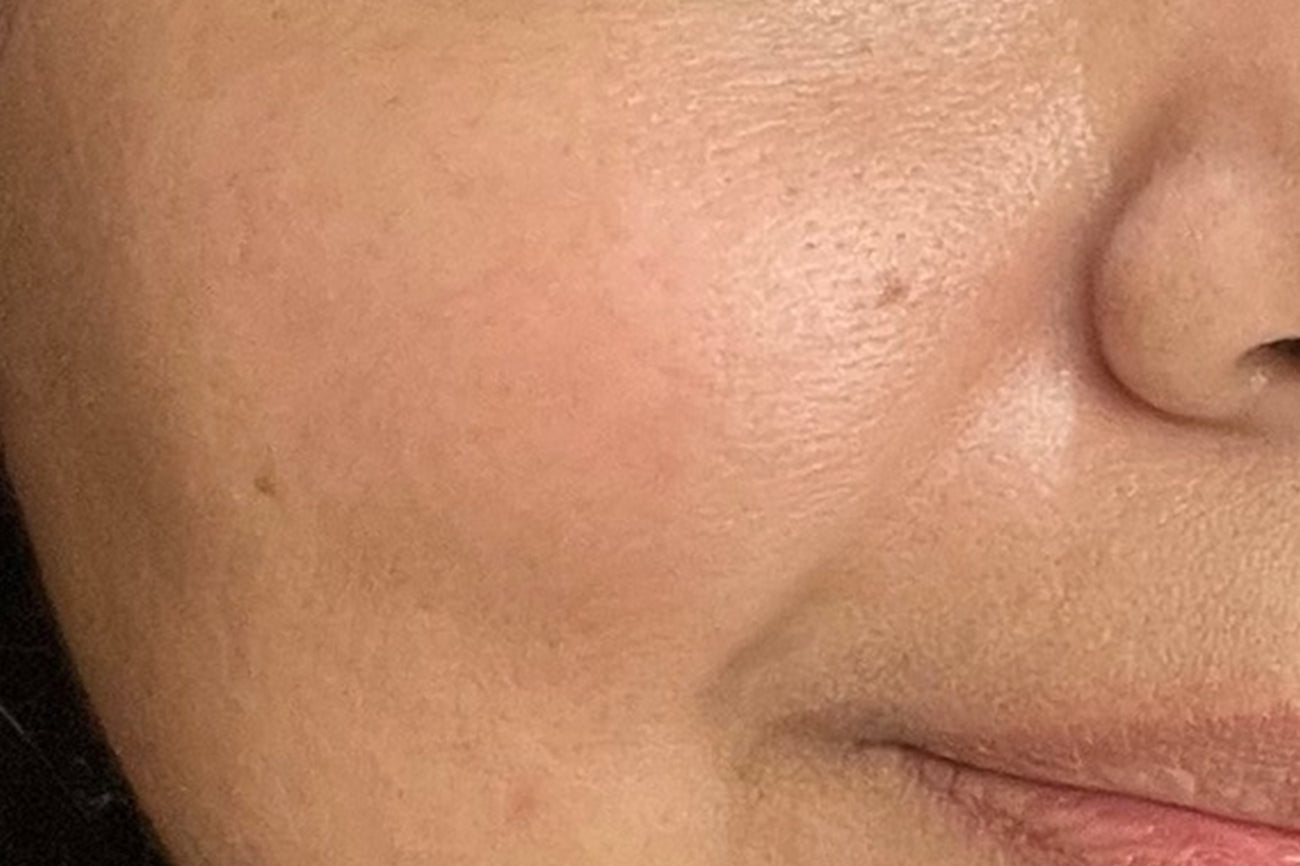 Barrier Renew® PM Moisturizer - RoC® Skincare