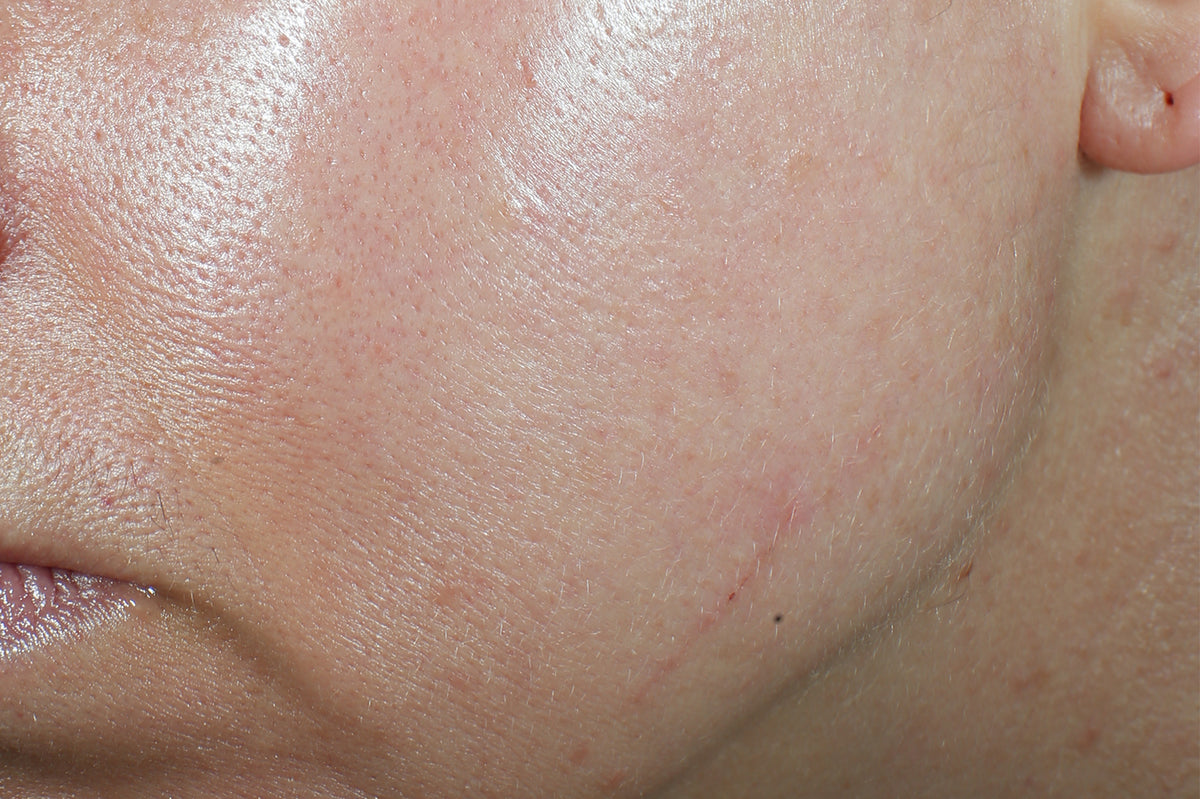 DERM CORREXION® Contour Cream - RoC®️ Skincare – RoC® Skincare