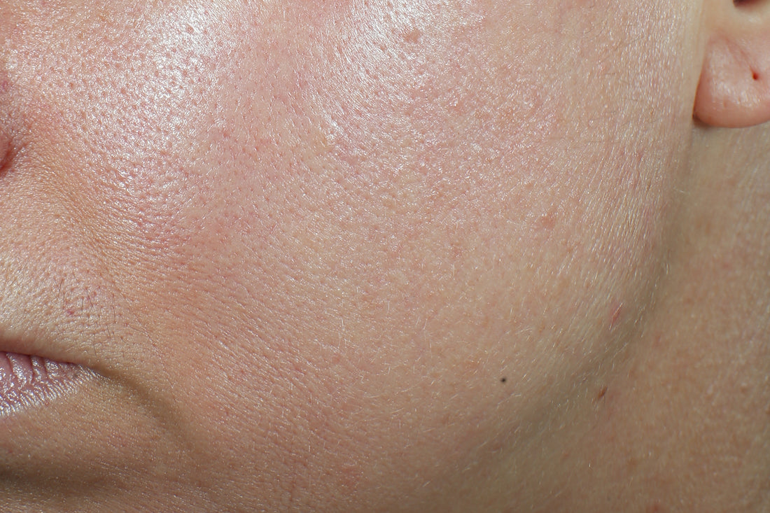 DERM CORREXION® Contour Cream - RoC®️ Skincare – RoC® Skincare