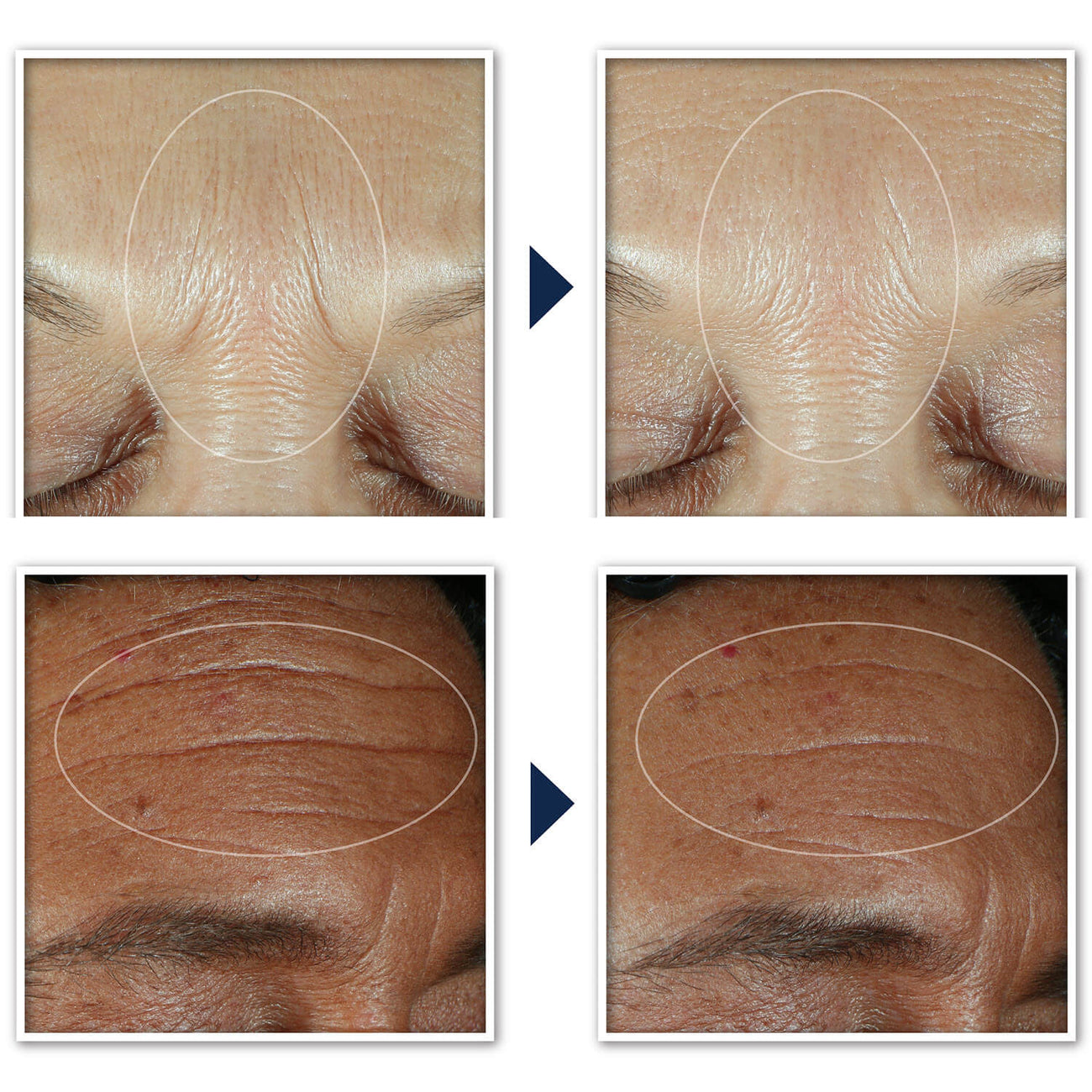 Clinically Proven Results - RoC® Skincare