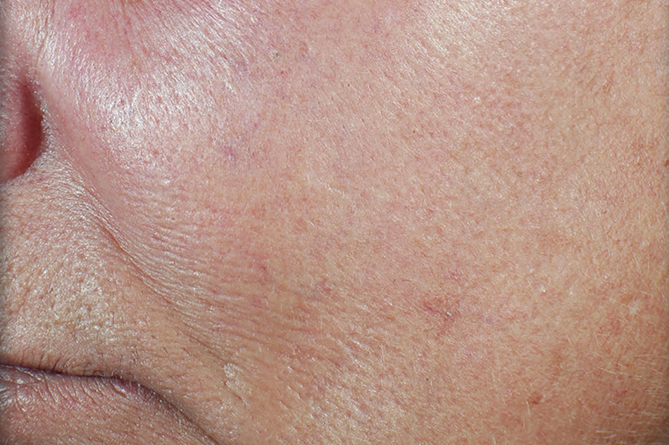 DERM CORREXION® Firming Serum Stick - RoC®️ Skincare – RoC® Skincare