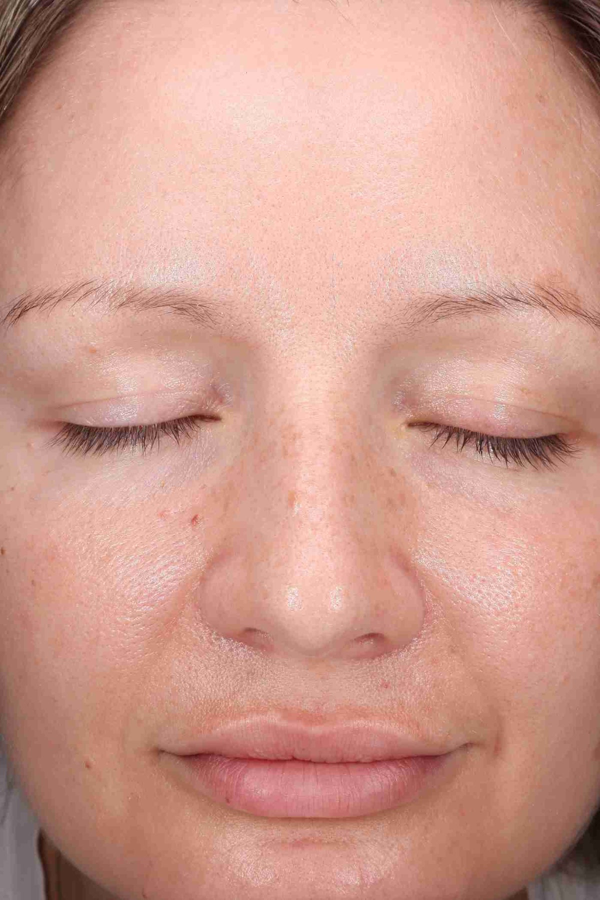 Clinically Proven Results - RoC® Skincare