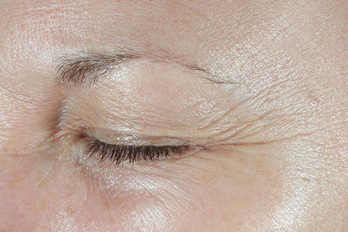 Hydration+ Moisturizer - RoC®️ Skincare – RoC® Skincare